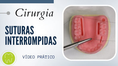 SUTURAS INTERROMPIDAS | Sutura em X | Ponto simples | Colchoeiro ...