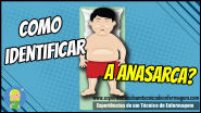 Como Identificar a Anasarca ? - Enfermagem