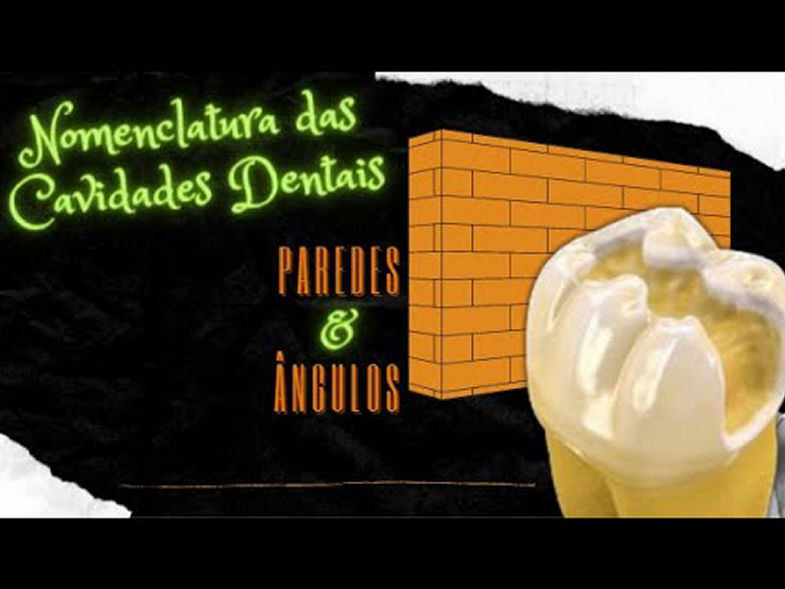Grátis: Classificação das Cavidades Dentárias I Paredes Ângulos da ...