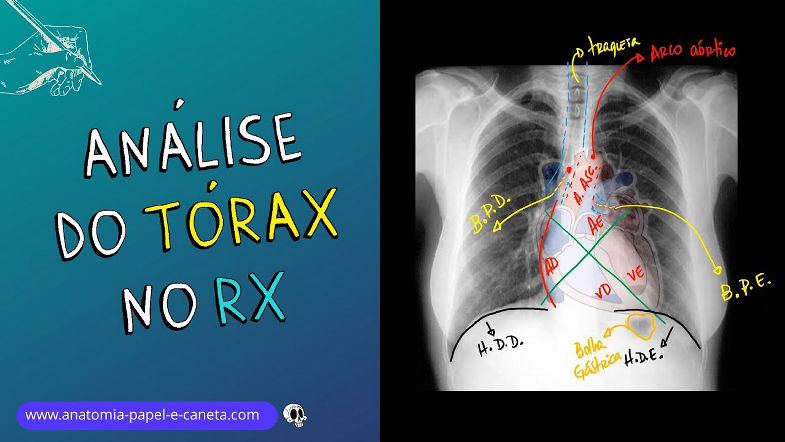 Grátis: Aprenda a analisar o exame de TÓRAX no RX - Resumo - Material ...