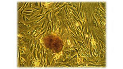 FiberCell Systems Hollow Fiber Cell Culture An Overview [720p ...