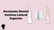 Aula de Anatomia Dental - Anatomia do Incisivo Lateral Superior - Dente ...