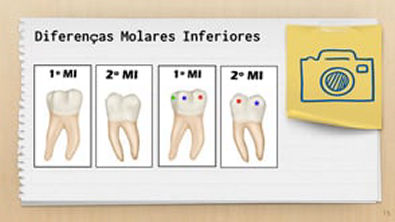 Diferenças Entre Molares Superiores e Molares Inferiores - Aula de ...