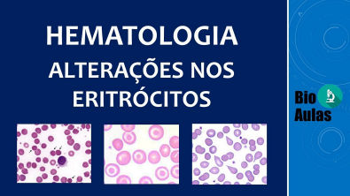 Anisocromia, Anisocitose e Poiquilocitose: Alterações no Hemograma ...